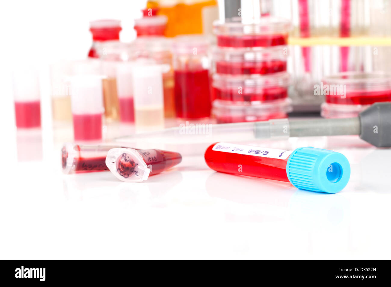 Vacutainer blood tube hi-res stock photography and images - Alamy
