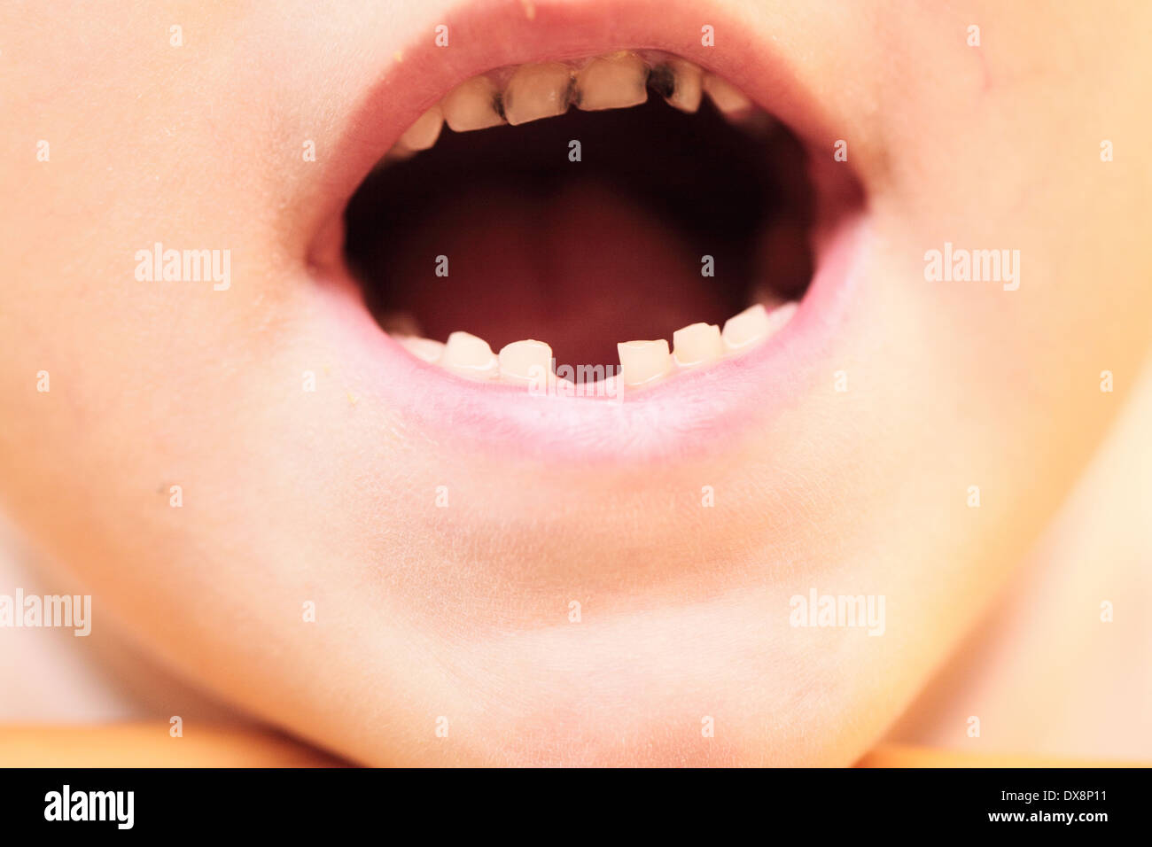 Without teeth hi-res stock photography and images - Alamy