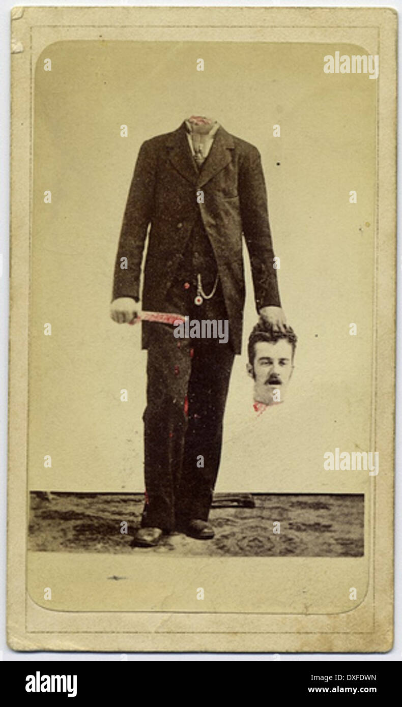 This vintage photograph is a staged trick image showing a decapitated ...