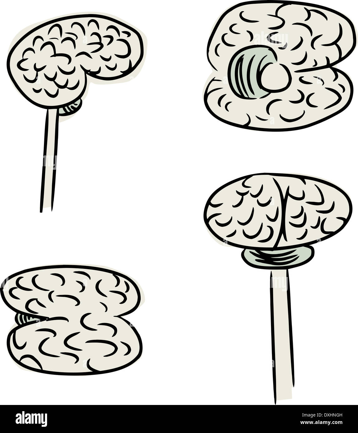 Different Views Of The Brain
