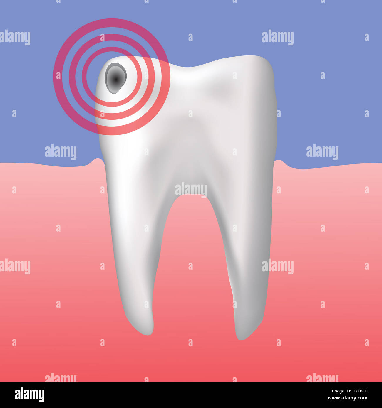 colorful illustration with hole in the tooth for your design Stock ...
