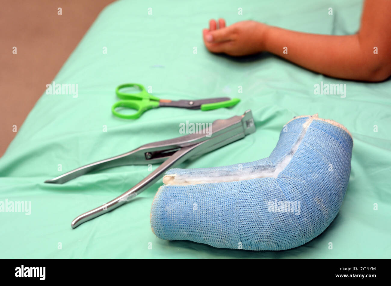 Children Cast Arm High Resolution Stock Photography and Images - Alamy
