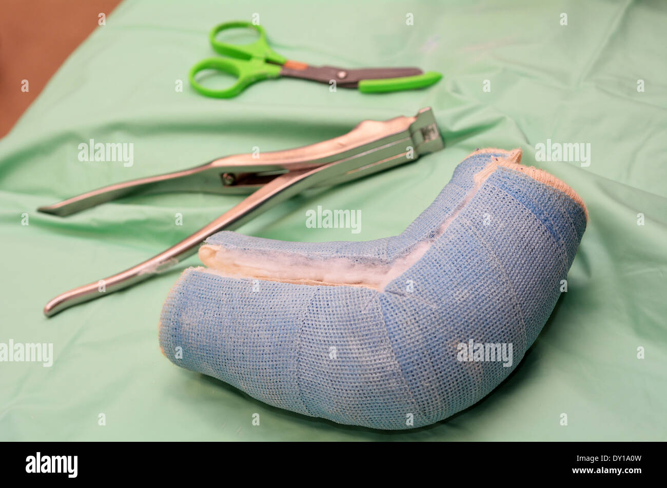 Children Cast Arm High Resolution Stock Photography and Images - Alamy