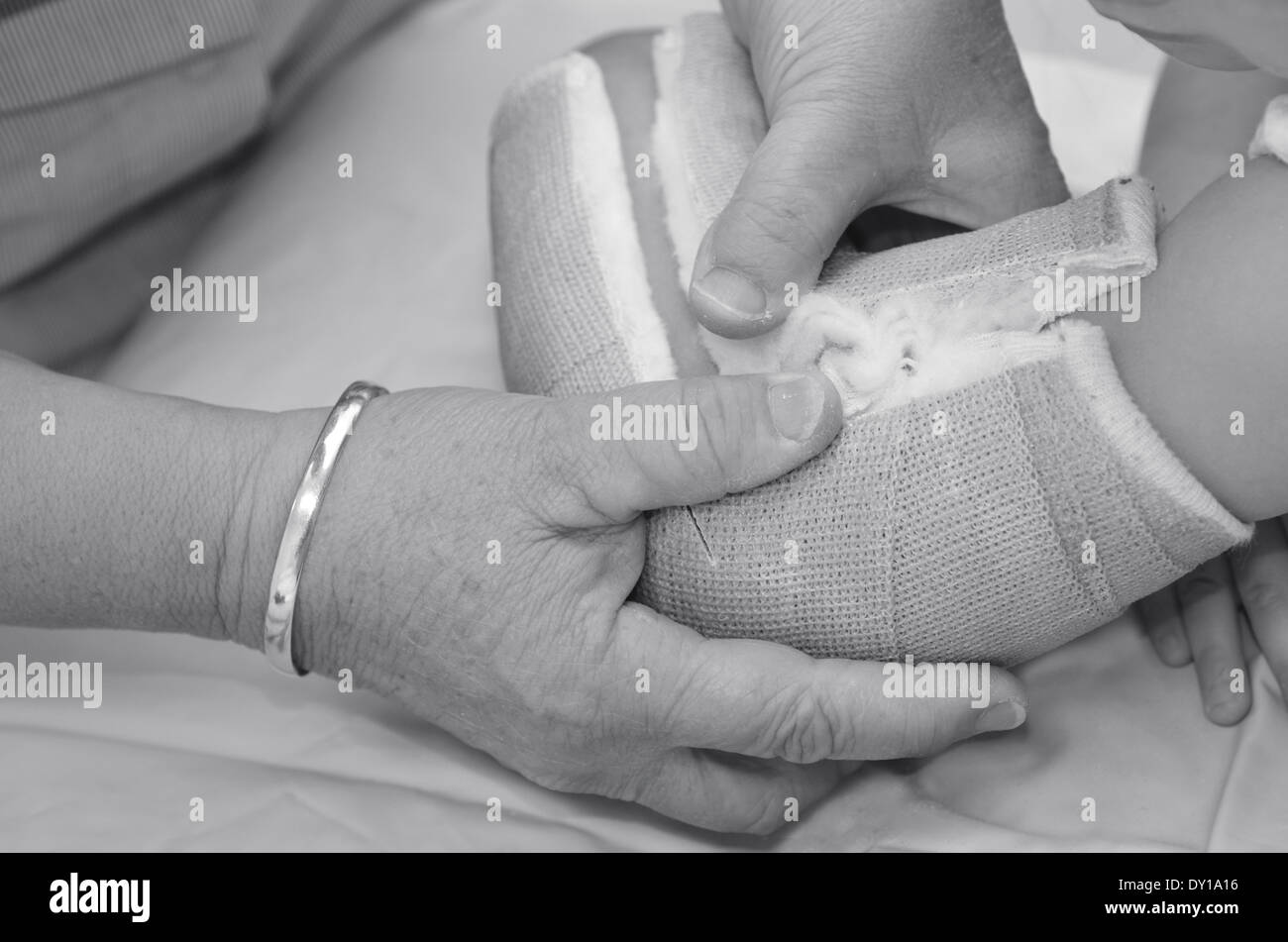 Child Broken Arm Nurse High Resolution Stock Photography and Images - Alamy
