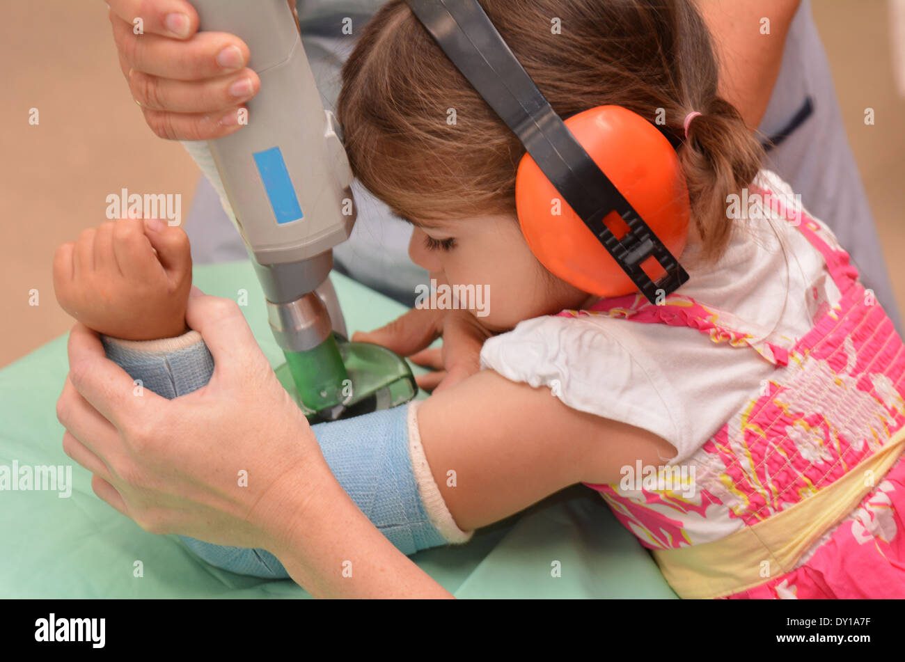 Girl Arm Plaster Cast High Resolution Stock Photography and Images - Alamy