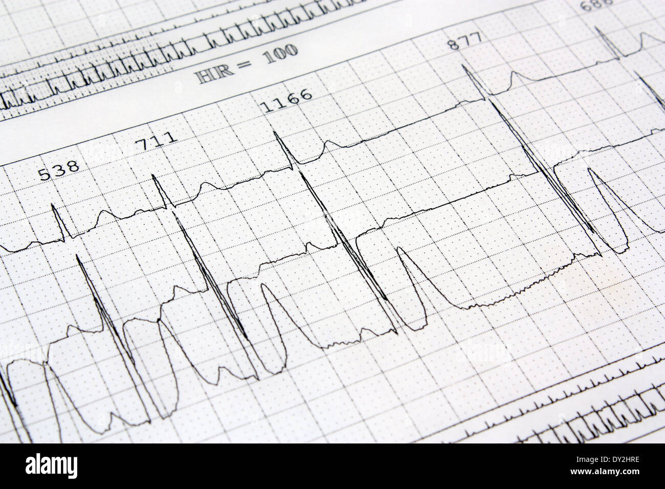 Electrocardiogram ekg heart rhythm background Stock Photo - Alamy