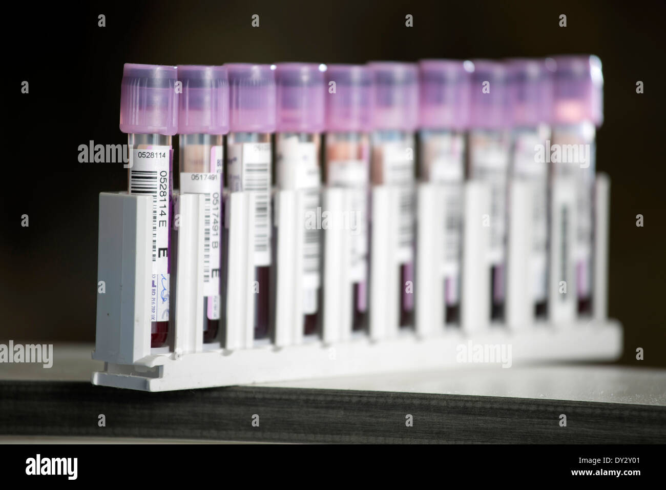 Vacutainer blood tube hi-res stock photography and images - Alamy