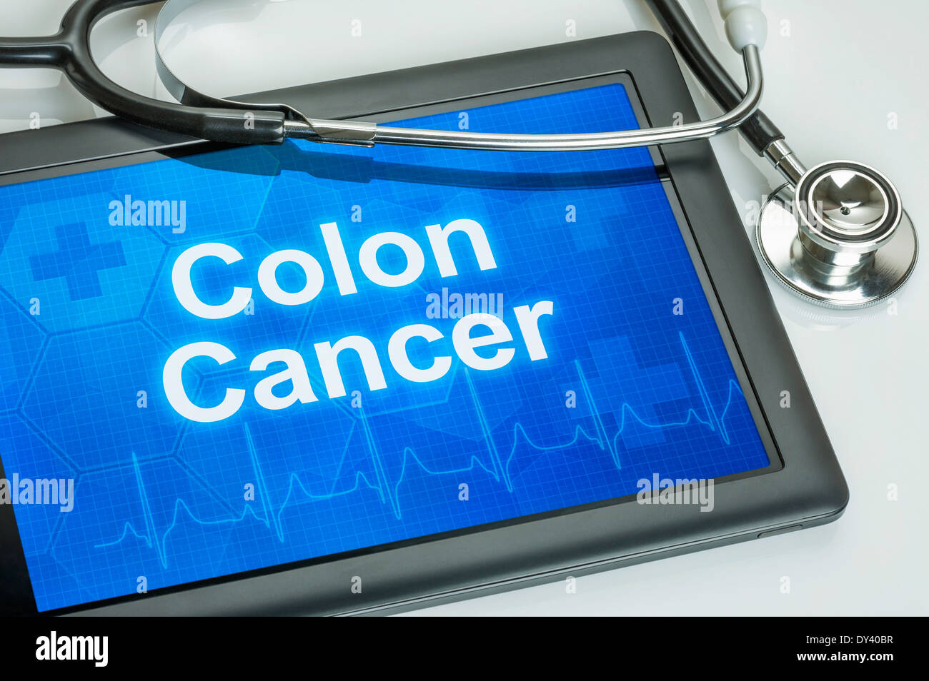 Tablet with the diagnosis colon cancer on the display Stock Photo - Alamy
