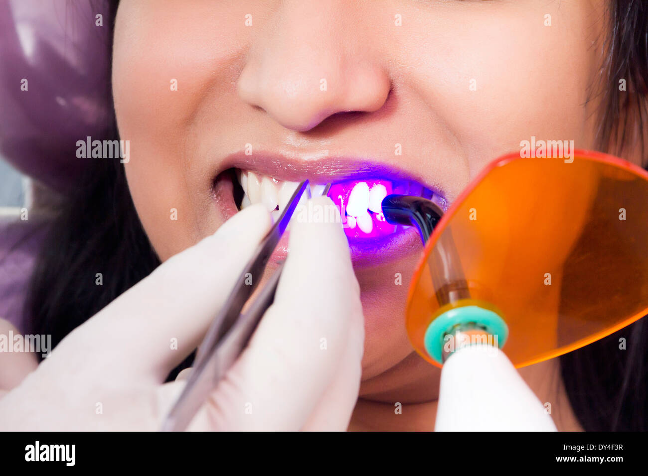 Indian Dentist Checking Teeth Stock Photo - Alamy