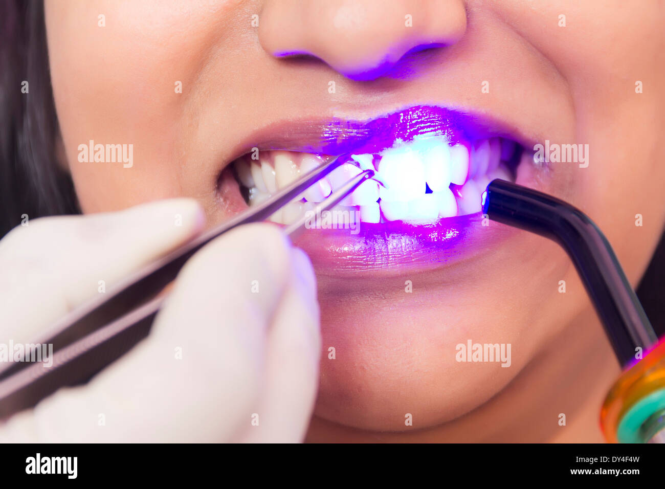 Indian Dentist Checking Teeth Stock Photo - Alamy