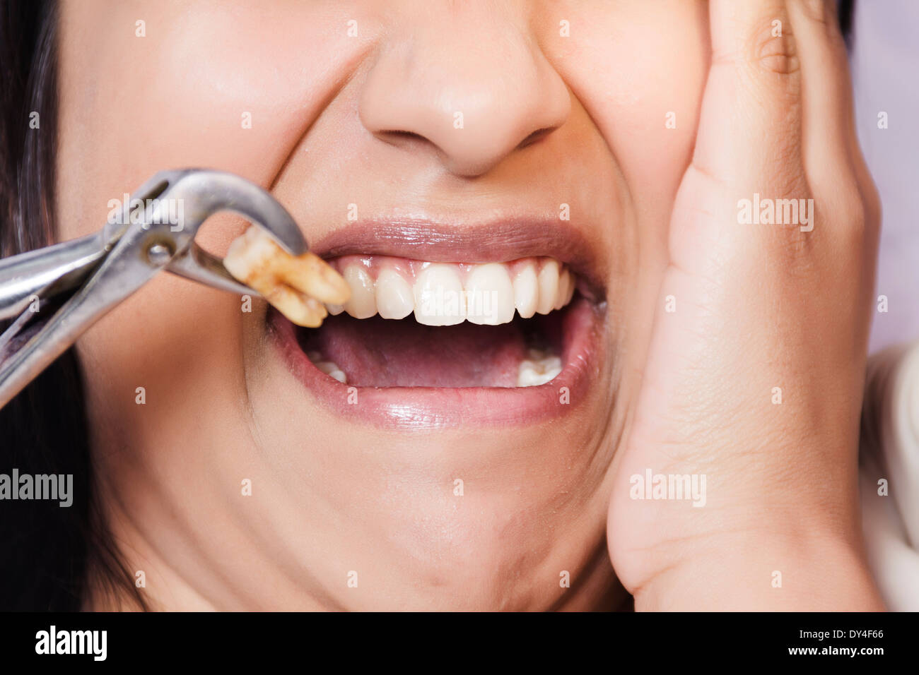 Indian Dentist Checking Teeth Stock Photo - Alamy