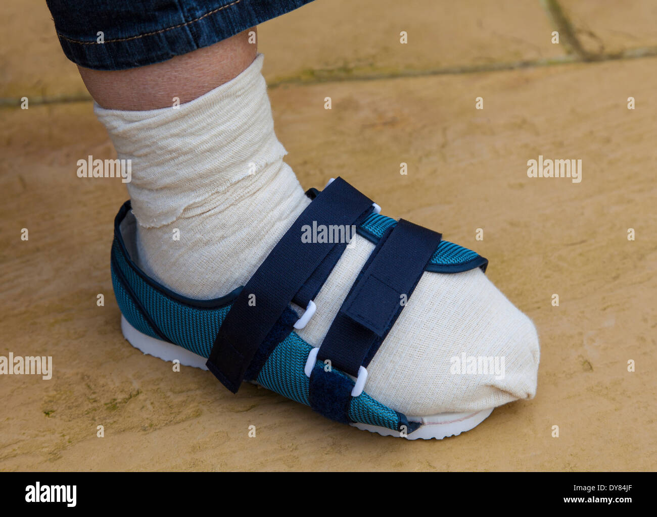 Foot cast hi-res stock photography and images - Alamy