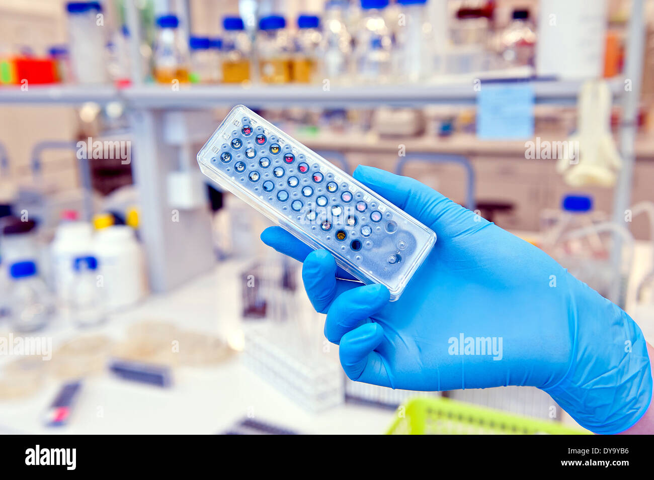 hand in glove holding microbiology test for bacterial detection Stock ...