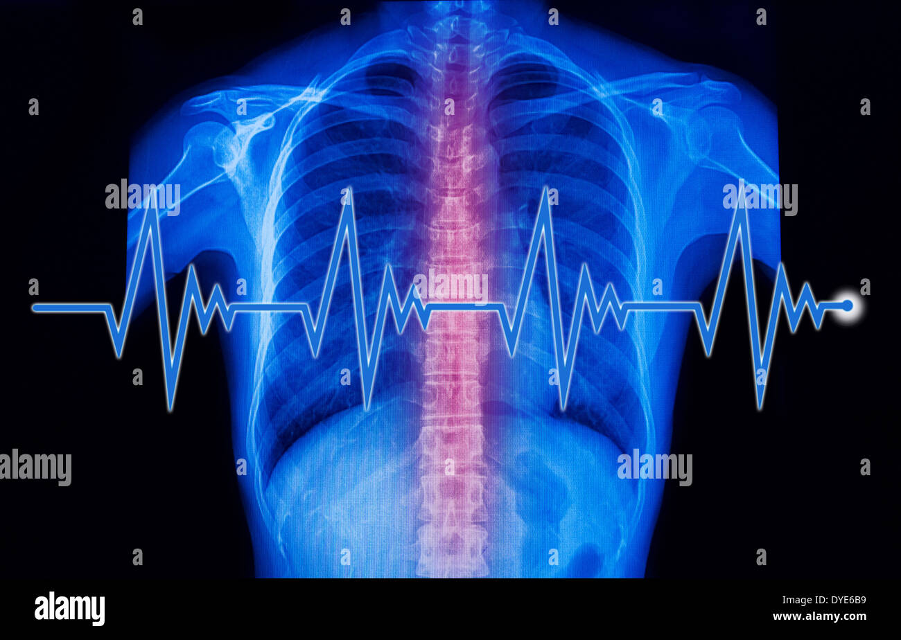 Abstract health and medical backgrounds showing x-ray image and EKG ...