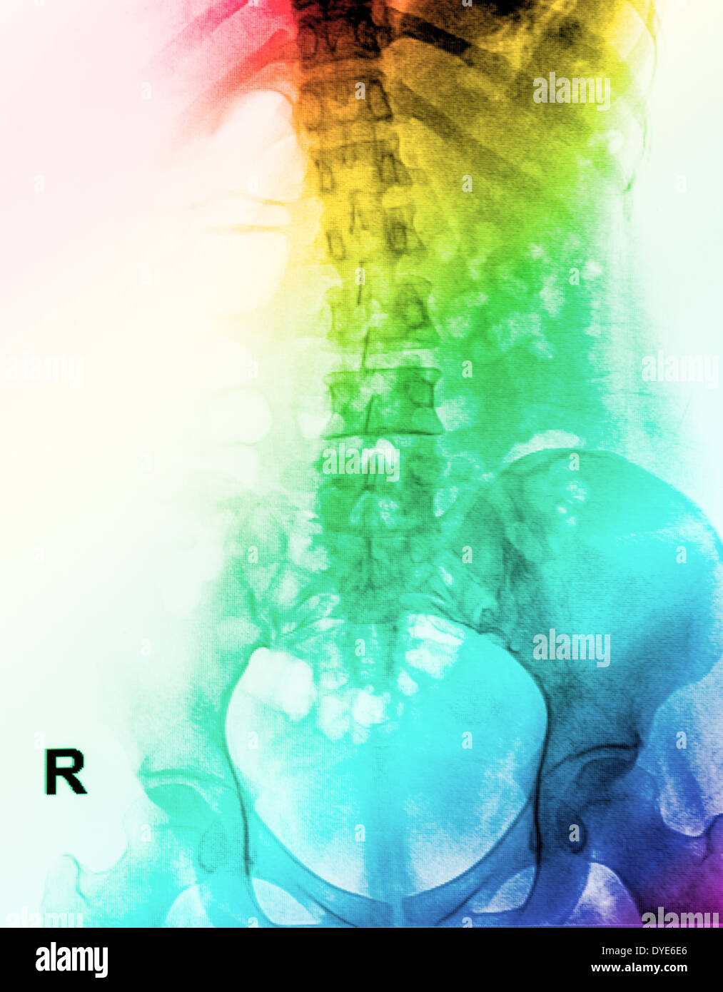 Human spinal column hi-res stock photography and images - Alamy