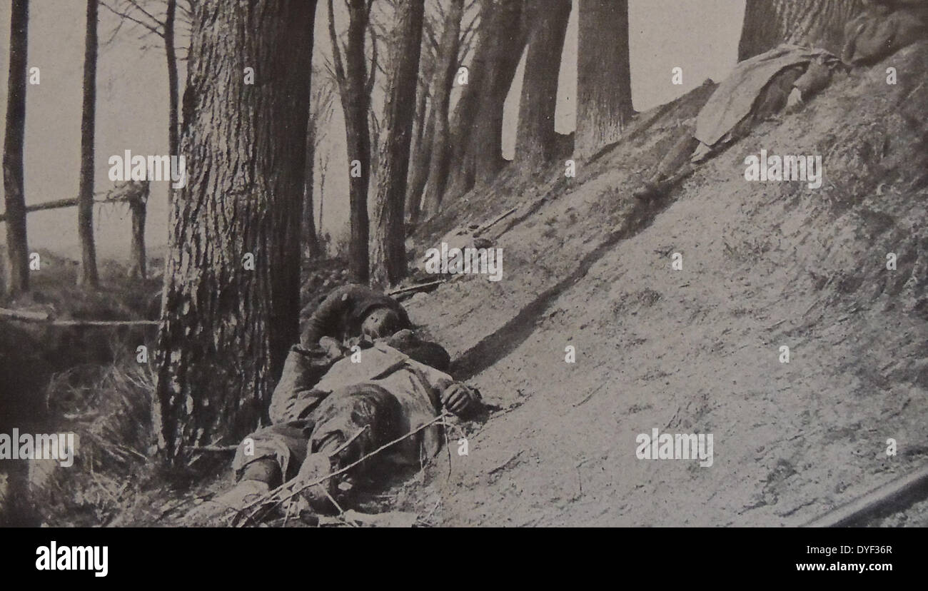 French casualties on the western front at Calonne, during world war one ...