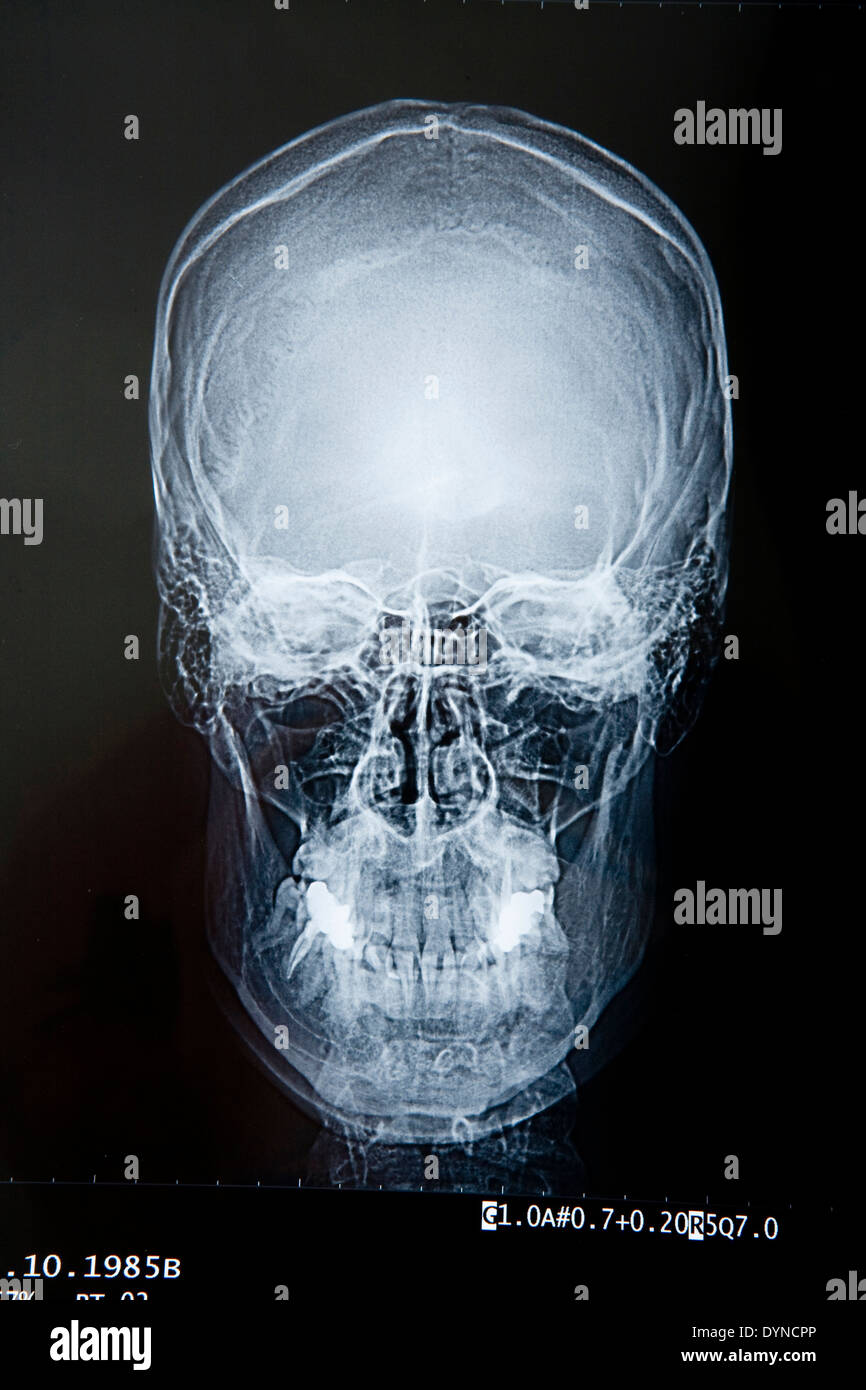 Skull likeness hi-res stock photography and images - Alamy
