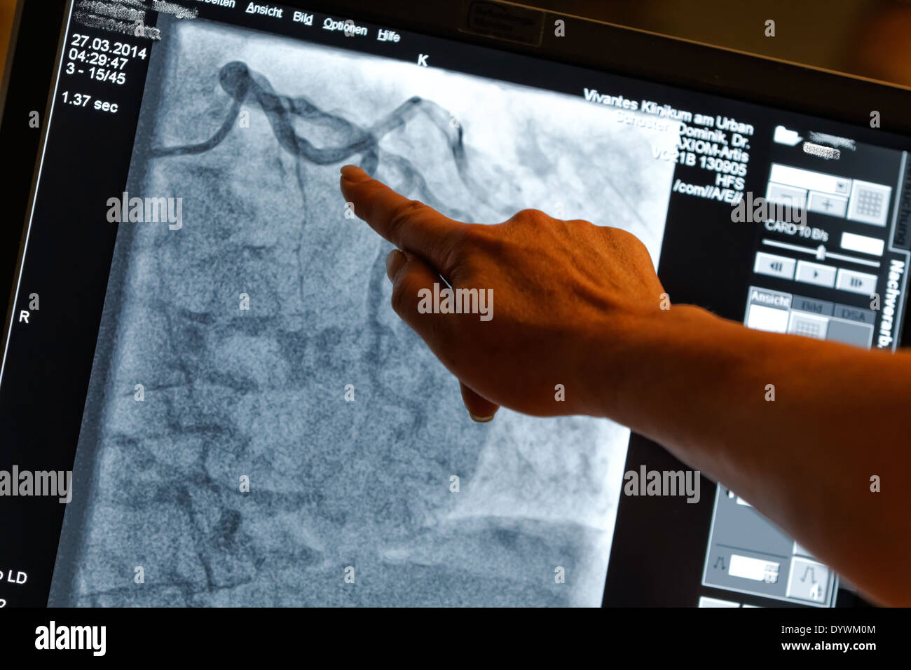 Heart operating room hi-res stock photography and images - Alamy