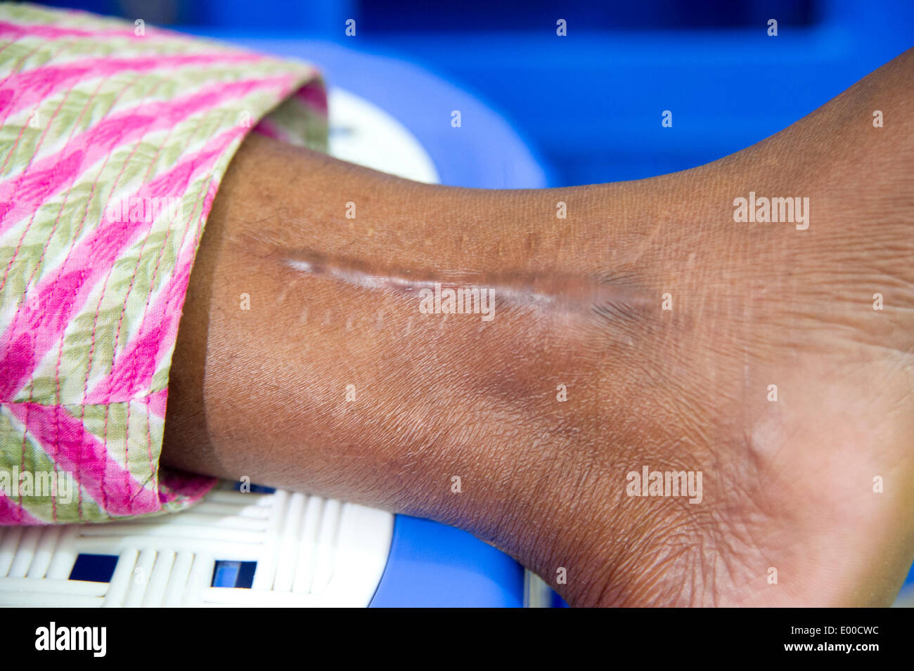 Tazreen fire hi-res stock photography and images - Alamy
