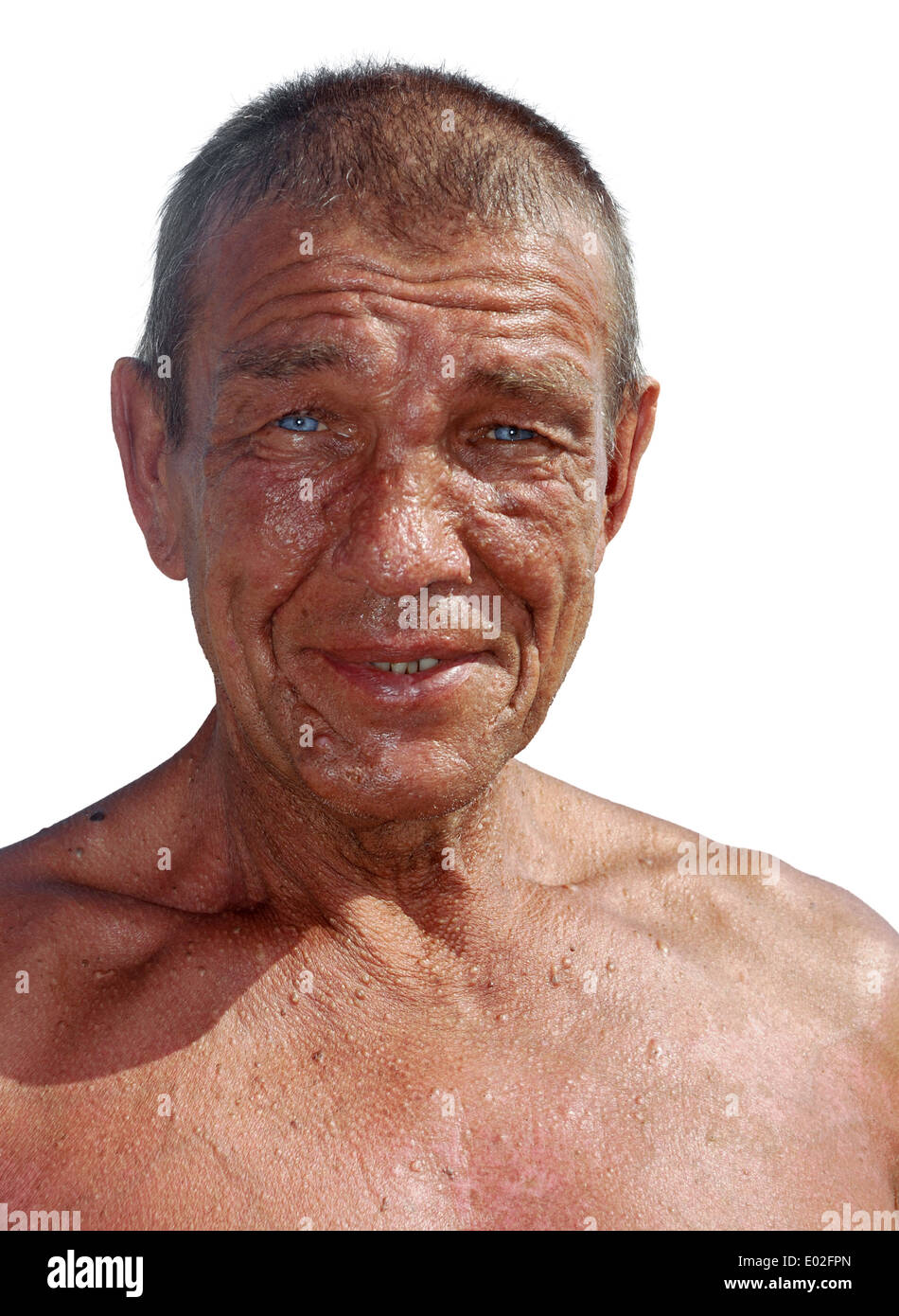 tanned tanned older man with wrinkles and skin problems Stock Photo - Alamy