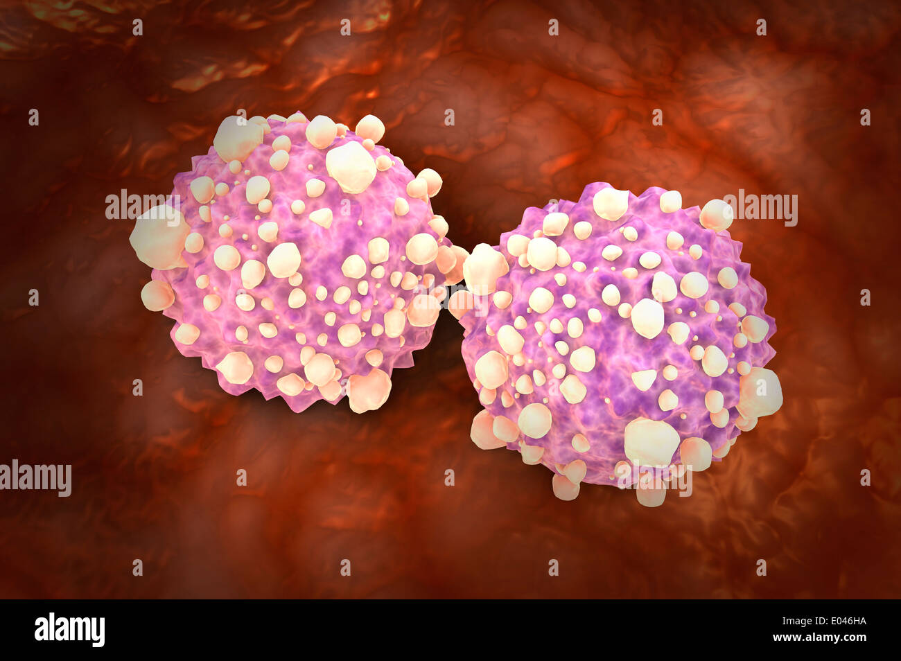 Microscopic view pancreatic cancer cells hi-res stock photography and ... Microscopic view pancreatic cancer cells hi-res stock photography and ...
