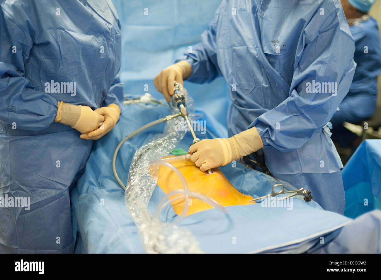 Gynecological surgery Stock Photo - Alamy