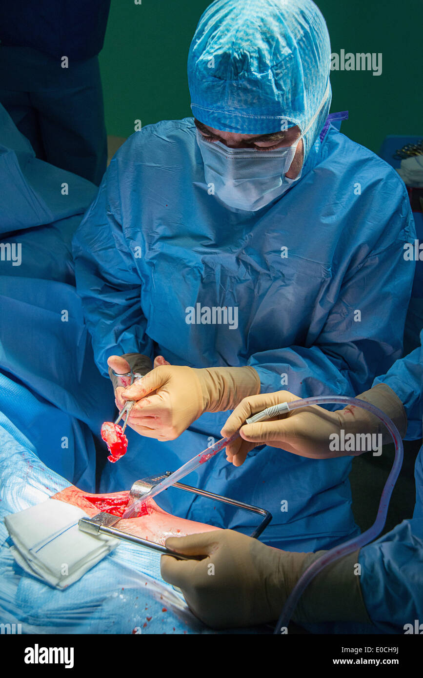 Hip prosthesis, surgery Stock Photo - Alamy