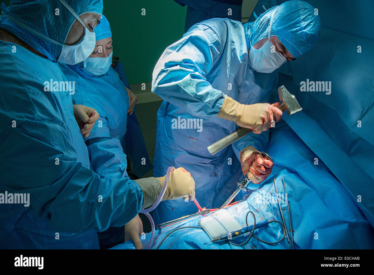 Hip prosthesis, surgery Stock Photo - Alamy