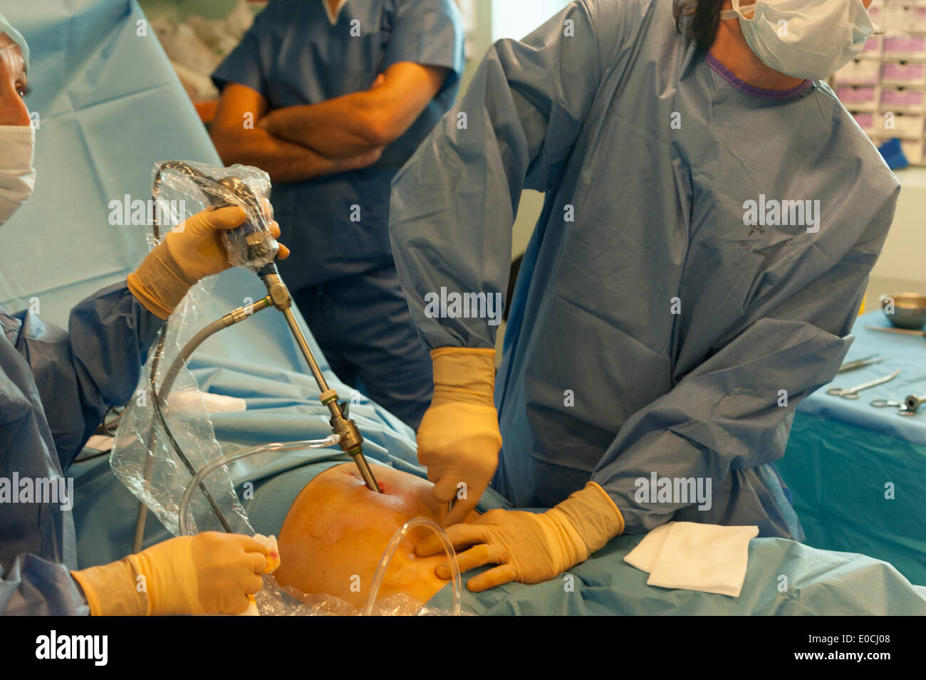 Gynecological operations hi-res stock photography and images - Alamy