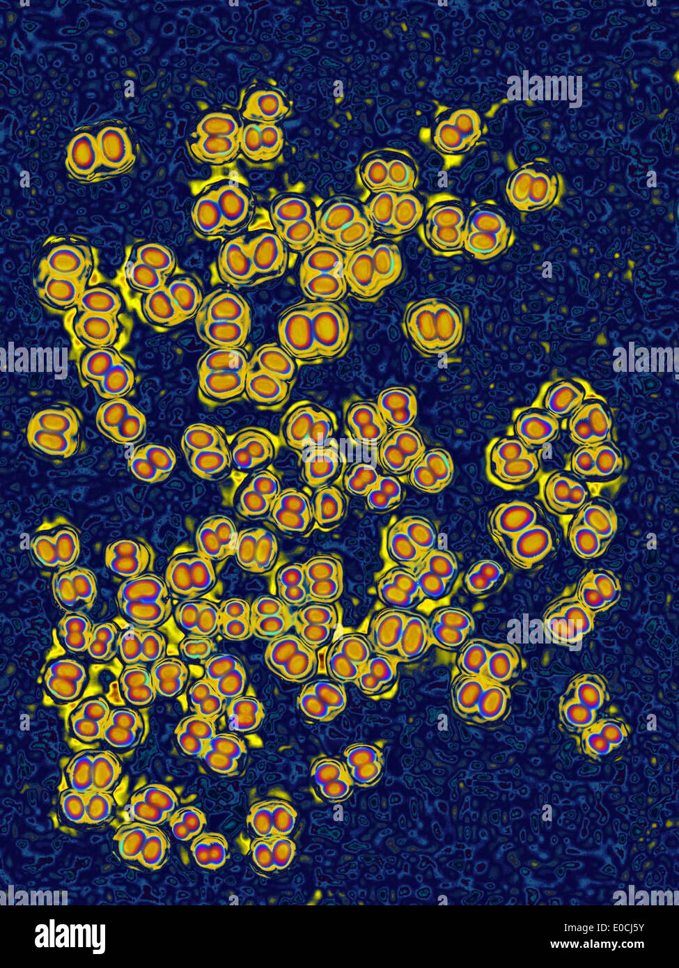 Gram negative neisseria meningitidis hi-res stock photography and ...