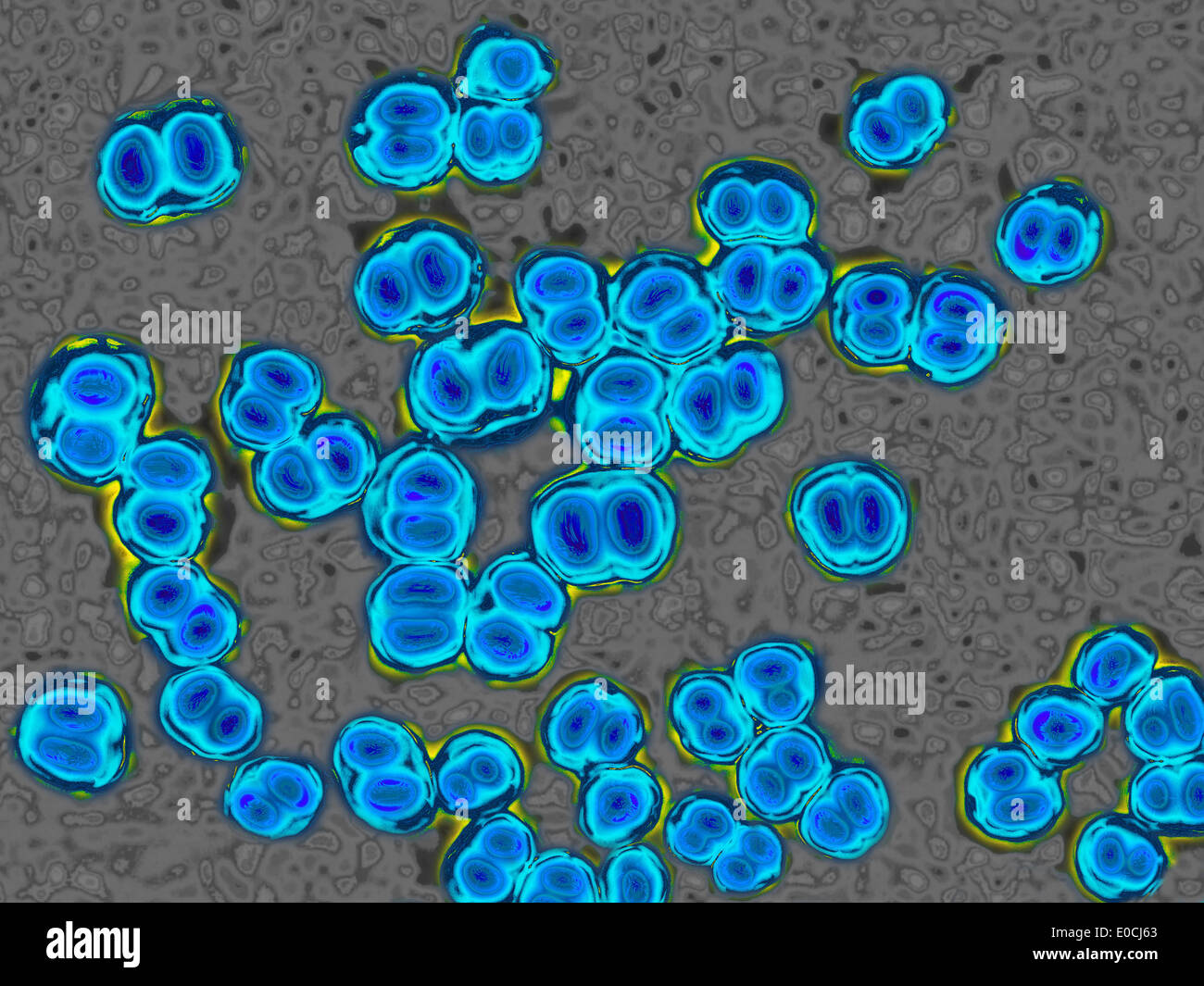 Neisseria meningitidis hi-res stock photography and images - Alamy
