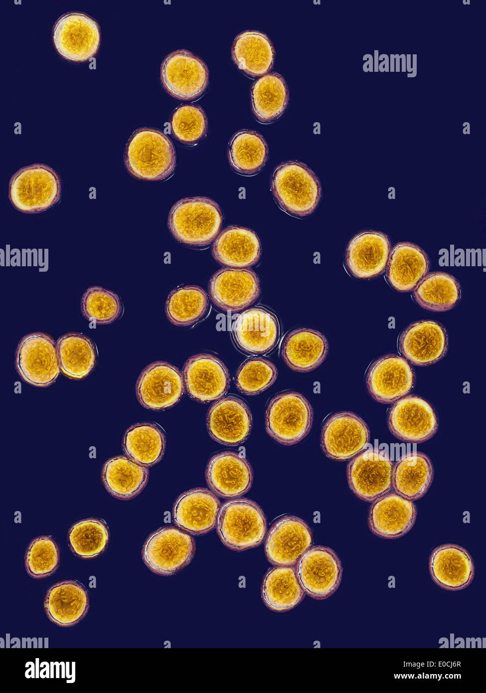 Staph aureus hi-res stock photography and images - Alamy