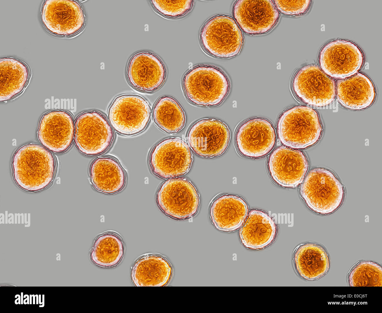 Staph aureus hi-res stock photography and images - Alamy