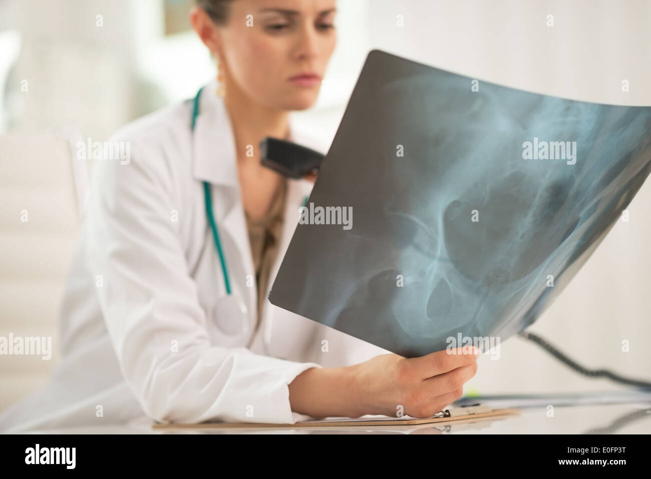 Closeup on medical doctor woman with phone looking on fluorography ...