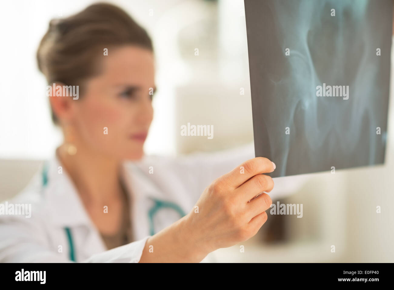 Closeup on medical doctor woman looking on fluorography Stock Photo - Alamy