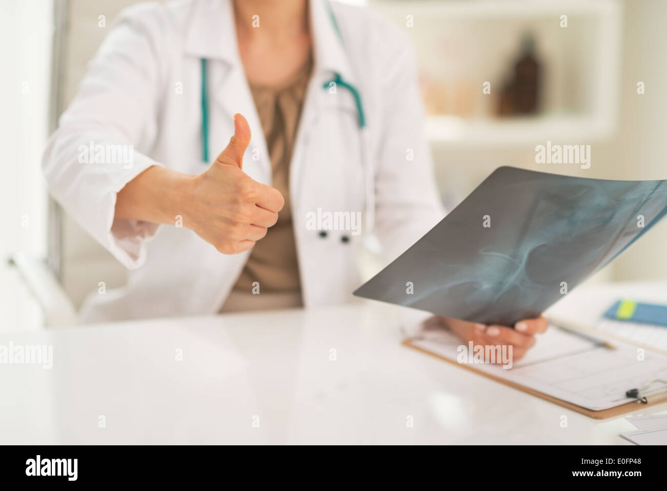 Closeup on medical doctor woman with fluorography showing thumbs up ...