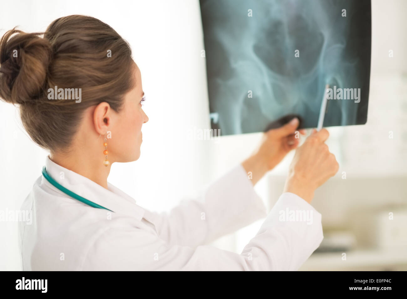 Medical doctor woman pointing on fluorography Stock Photo - Alamy