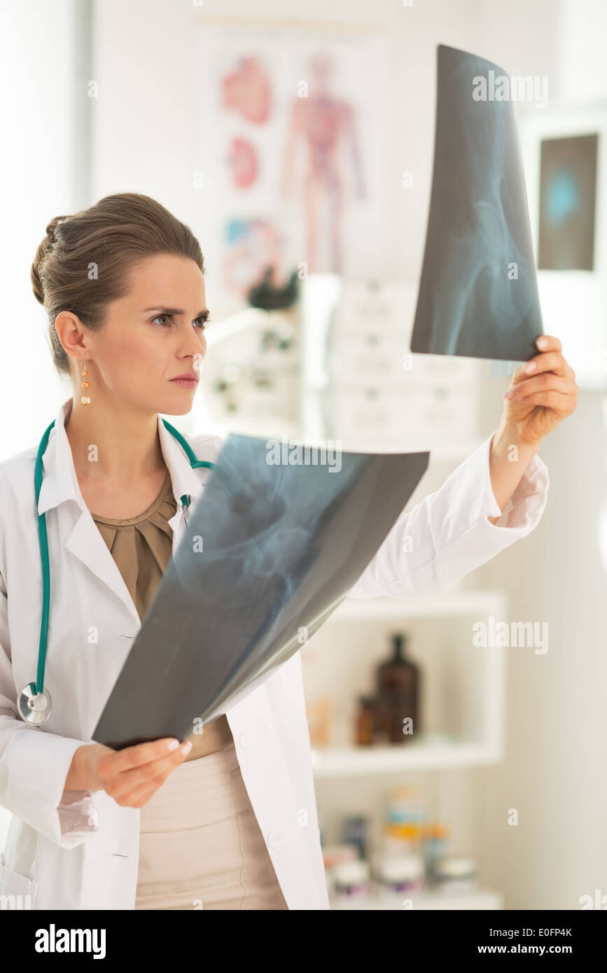 Medical doctor woman looking on fluorography in office Stock Photo - Alamy