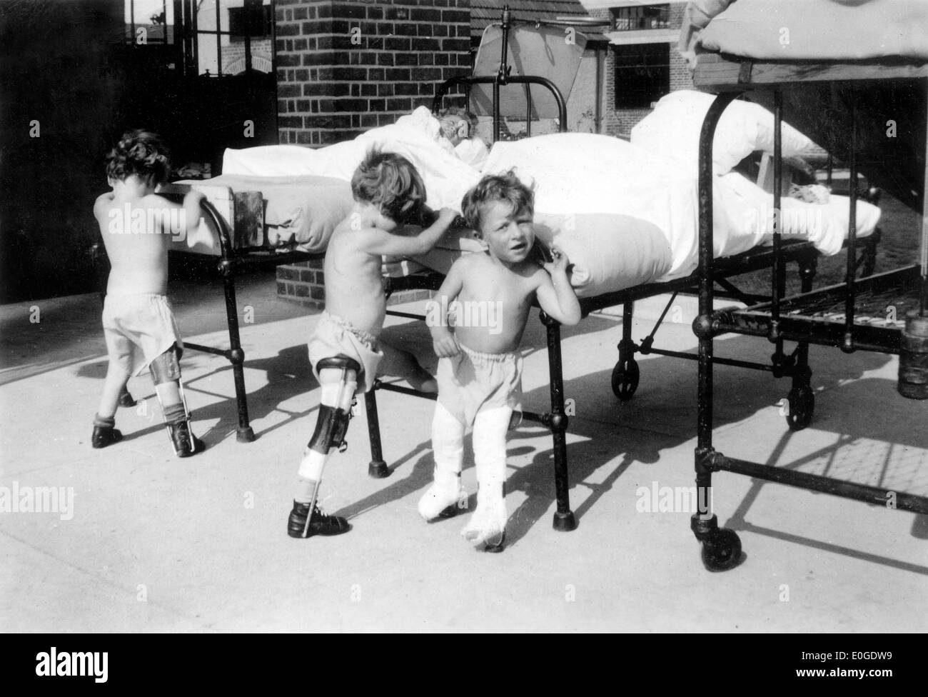 Children polio patients doing physiotherapy exercises wearing calipers ...