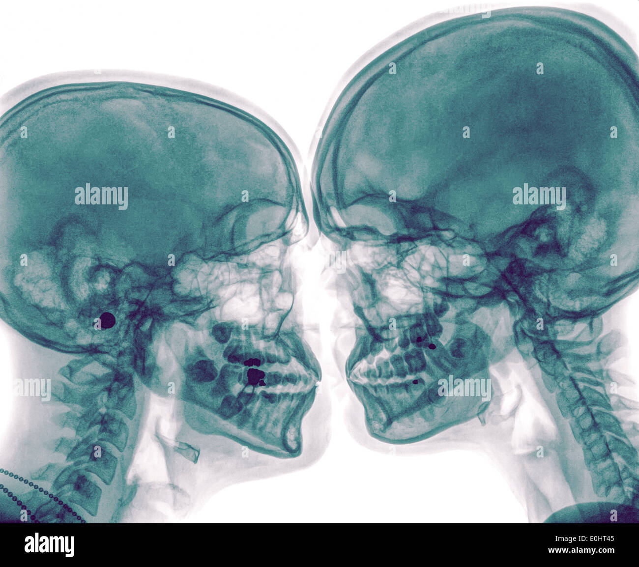 Xray skeleton bizarre hi-res stock photography and images - Alamy