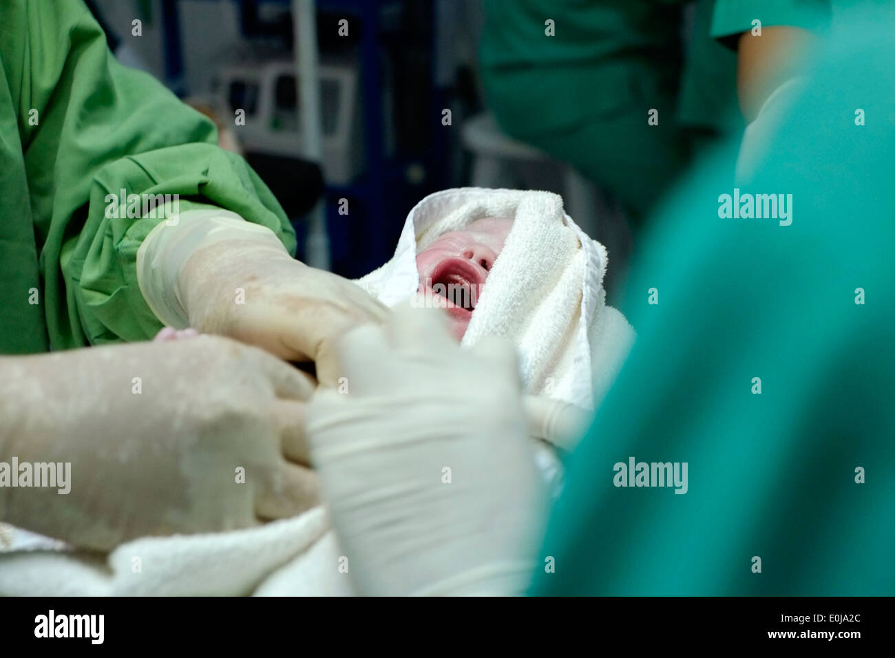 Operating theater cesarean section hi-res stock photography and images ...