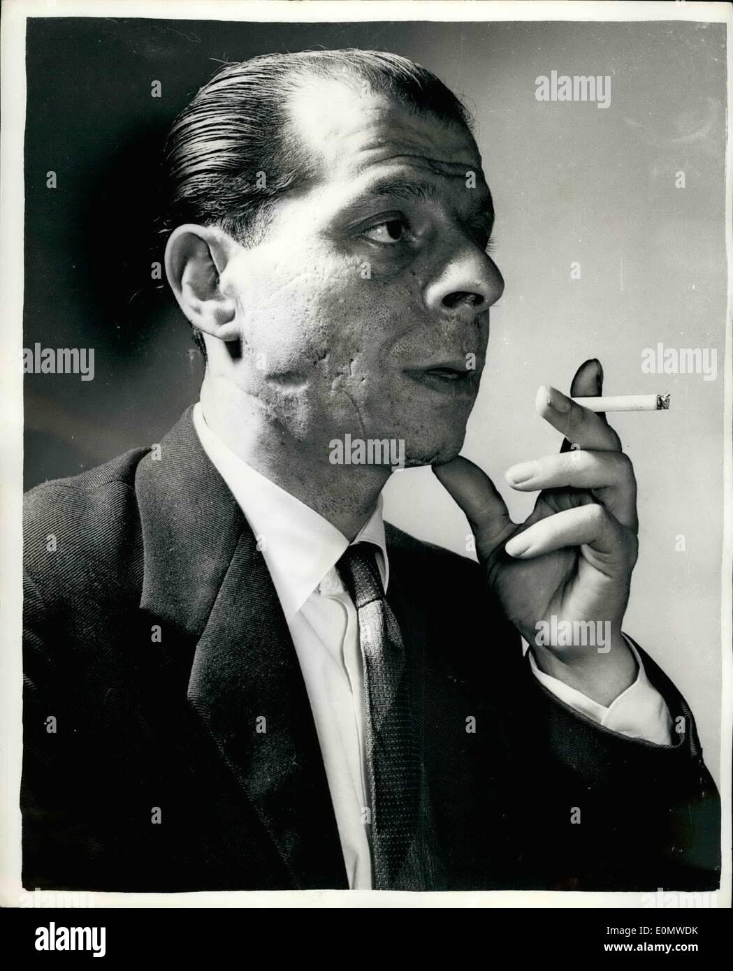 Jul. 07, 1956 - Why Victor Russo Is Called ''Scarface''. Photo shows ...
