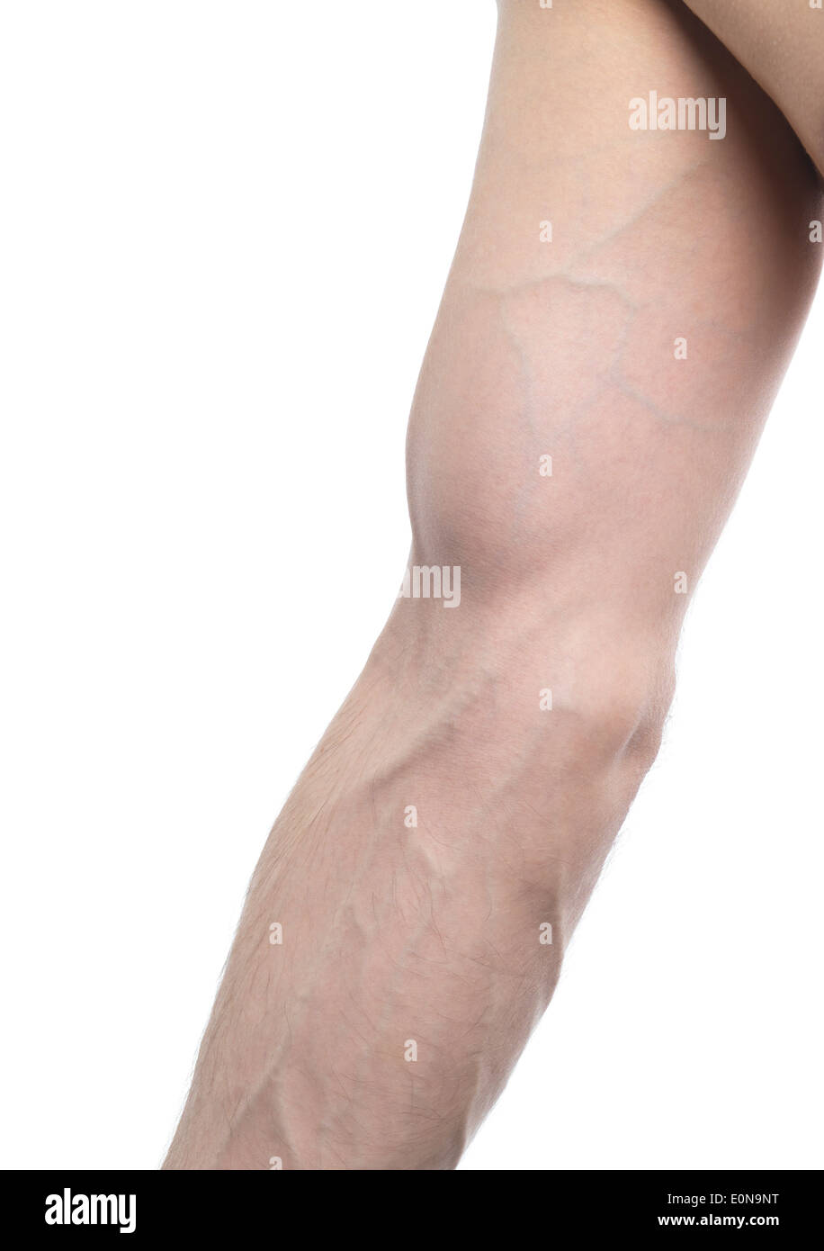 Closeup of man arm elbow and biceps isolated on white background Stock ...