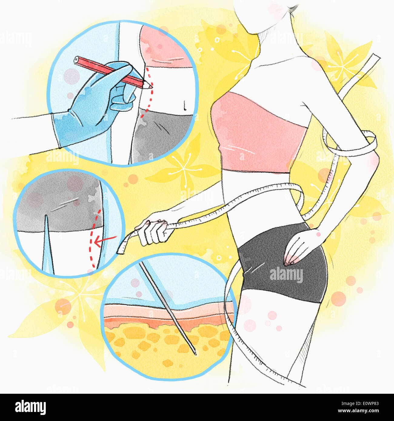 Plastic Surgery Perfect Body