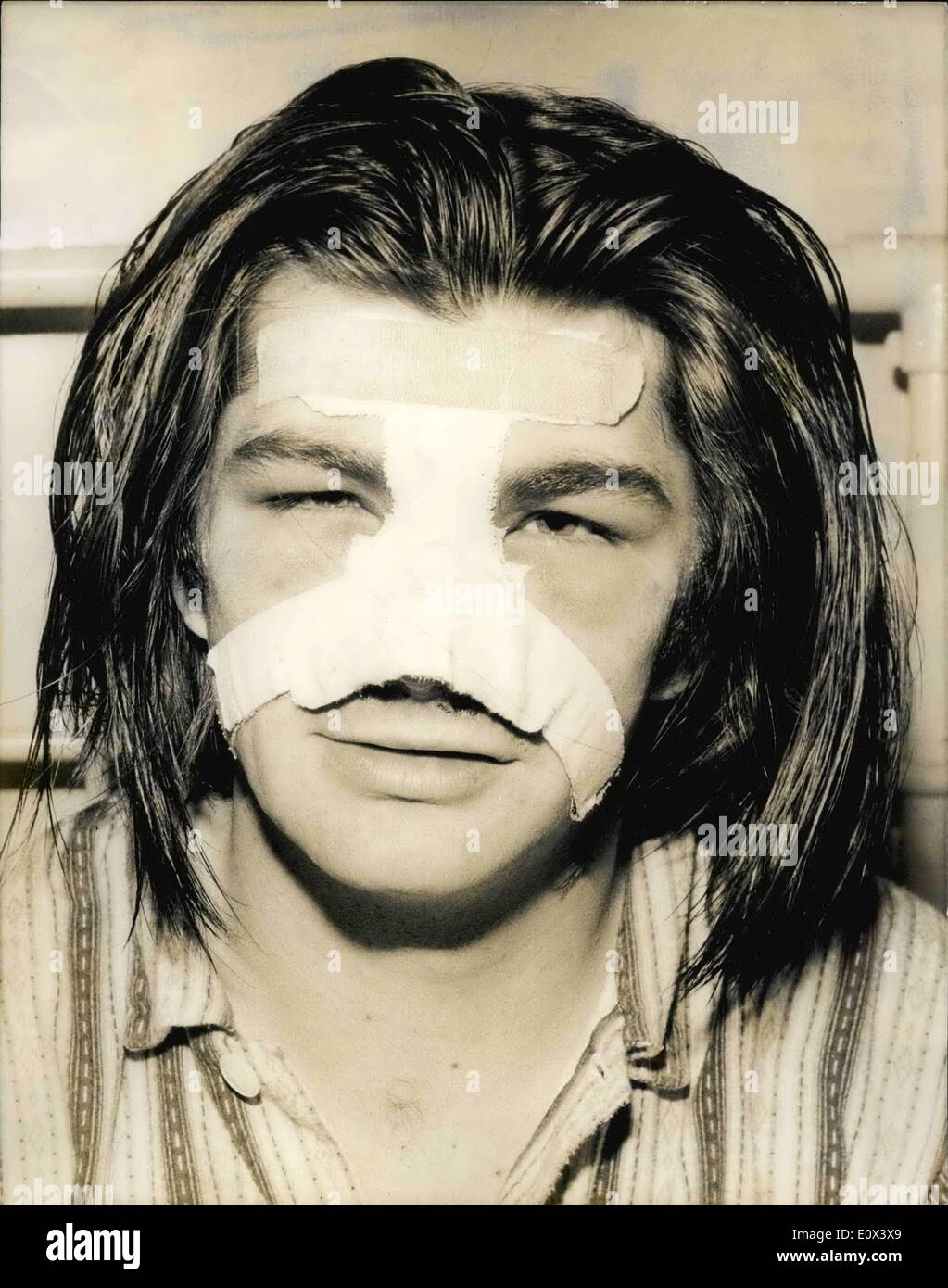 Feb. 02, 1965 - Screaming Lord Sutch Has A Nasal Operation At The ...