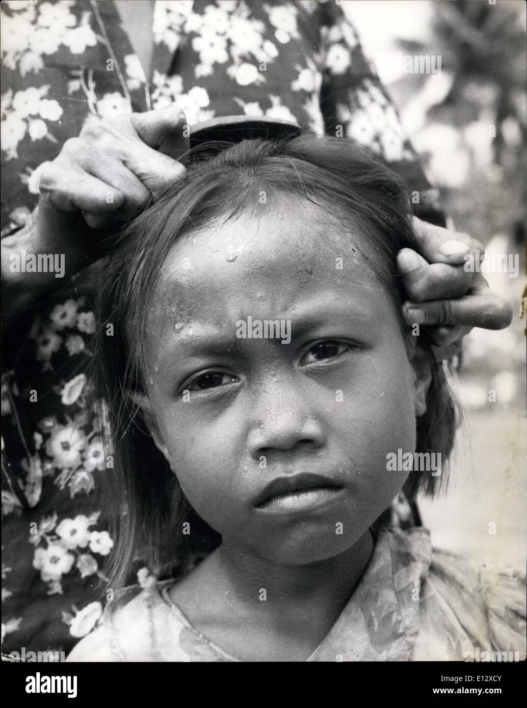 History of leprosy hi-res stock photography and images - Alamy