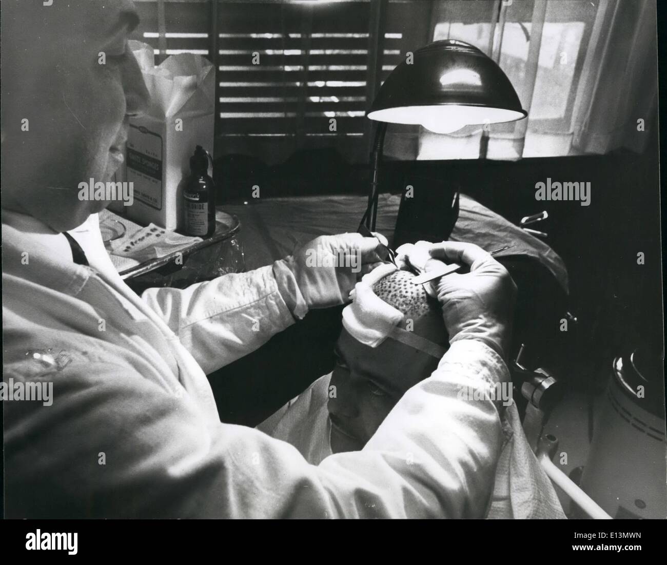 Mar. 22, 2012 - Hair plugs are taken from the lower head & ''plugged ...