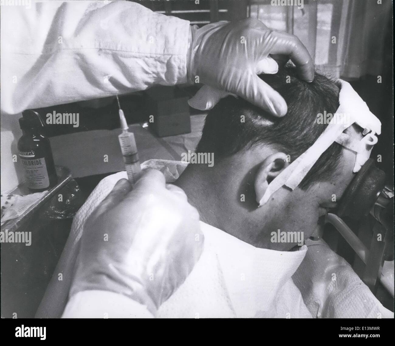 Mar. 22, 2012 - Hair Transplant - Hair plugs are taken from the lower ...