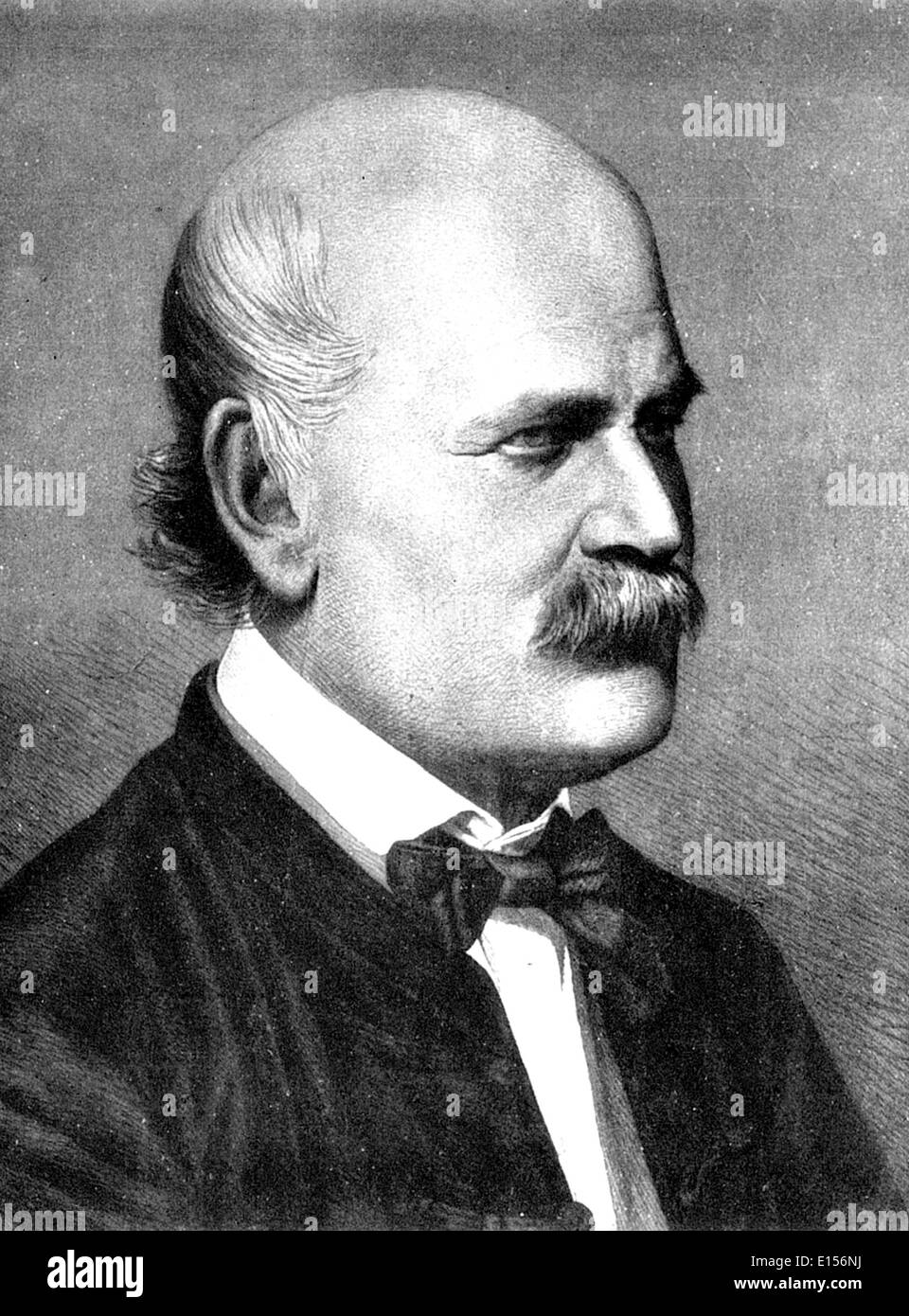 Ignaz semmelweis hi-res stock photography and images - Alamy