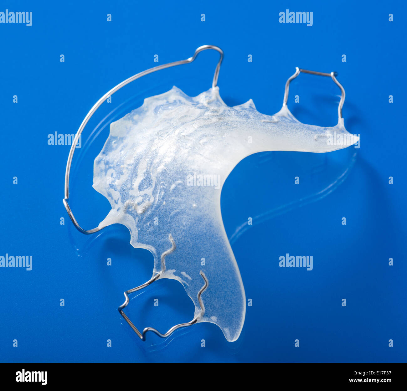 Orthodontic Brace Stock Photos & Orthodontic Brace Stock Images - Alamy